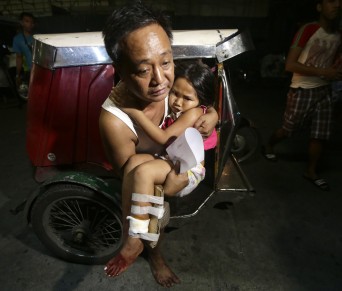 Firecracker injuries hit 933 cases | Inquirer News