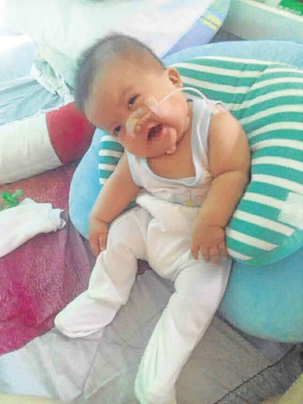 Baby born with multiple deformities needs cochlear implant | Inquirer News