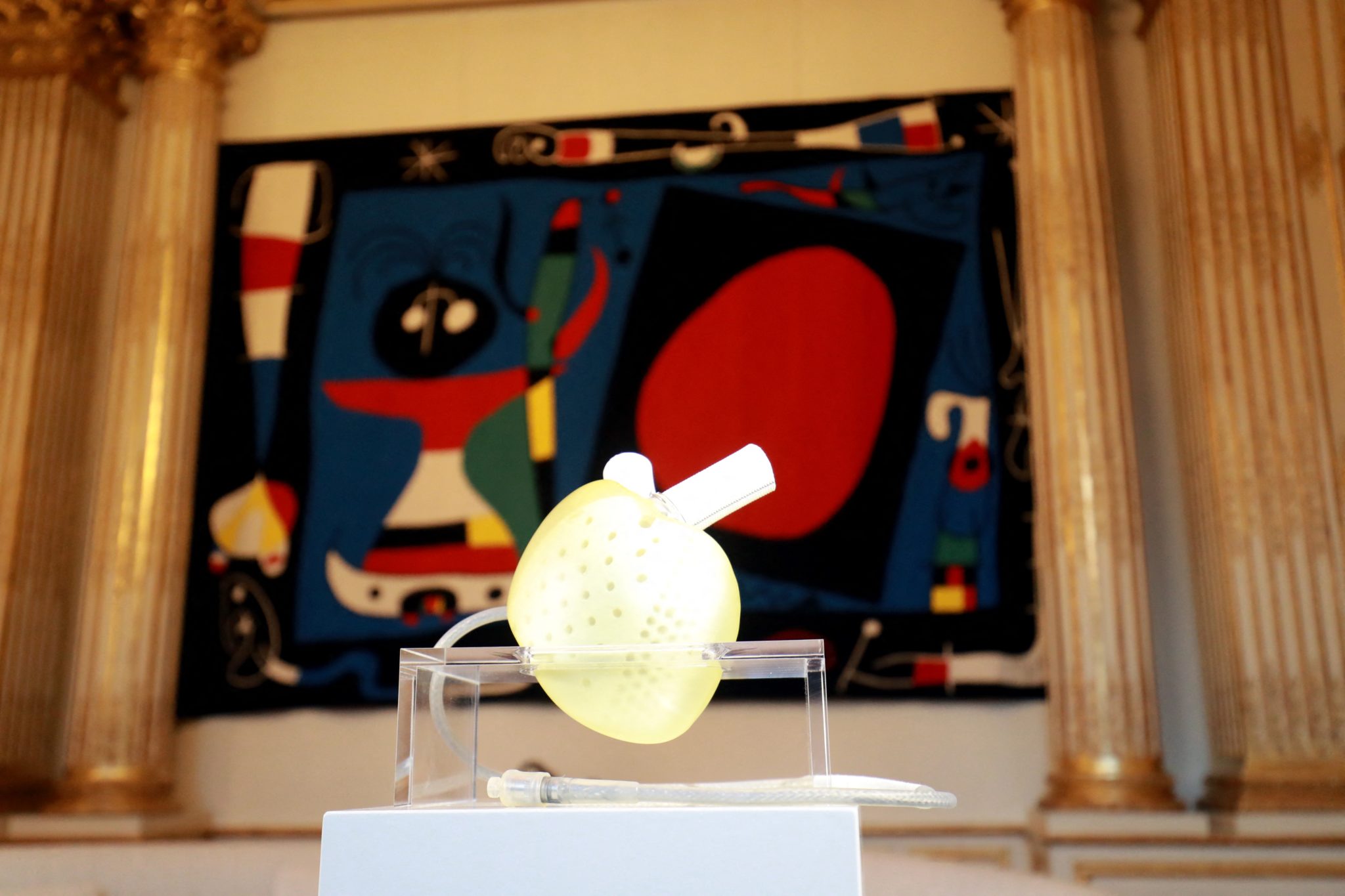 First US-based artificial heart implant for French firm | Inquirer News