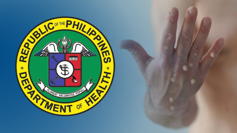 Suspected mpox cases monitored in Visayas, Mindanao