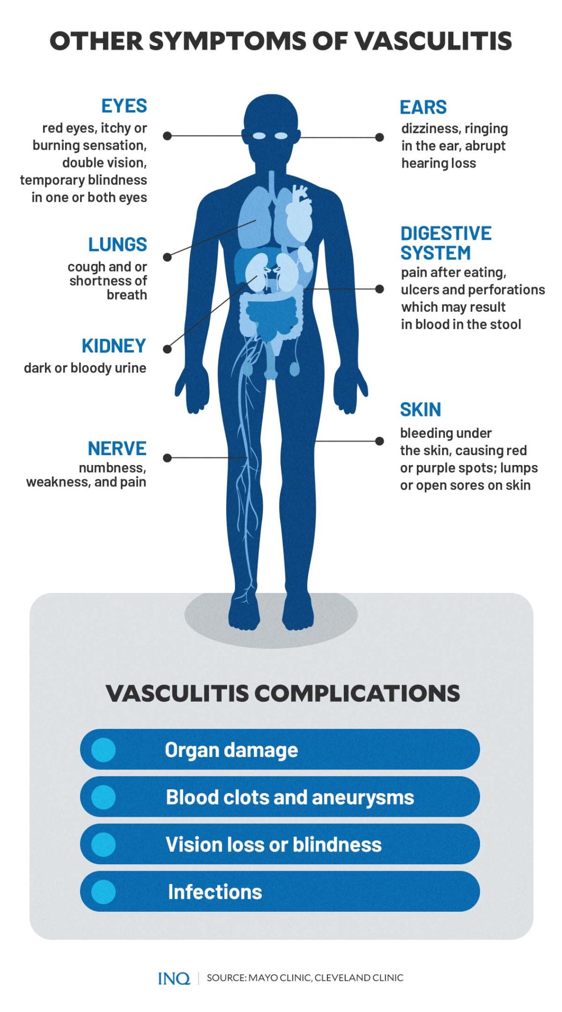 Vasculitis nearly turned Ashton Kutcher blind, paralyzed. What is it ...