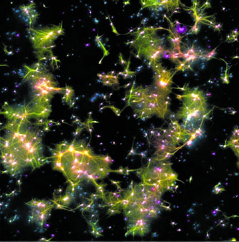 Brain cells in lab dish learn to play video game | Inquirer News