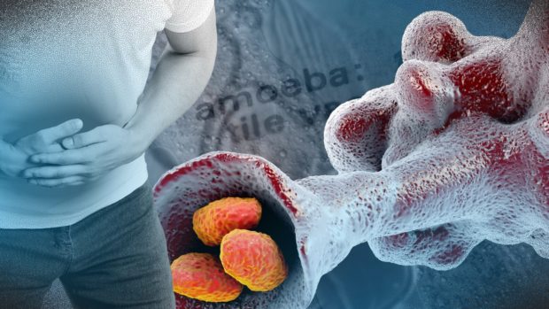 Amoebiasis rising: When your water, food contain sh…t | Inquirer News