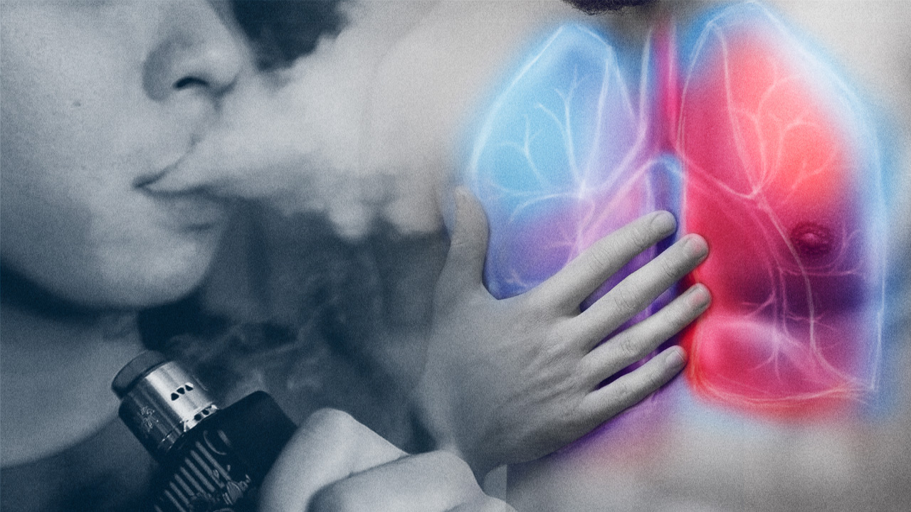 DOH issues guidelines on reporting, managing vape-related injury, death ...