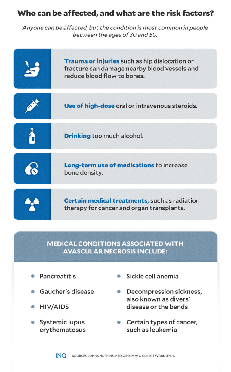 Osteonecrosis or 'bone death': What to know about Angelica Panganiban's ...