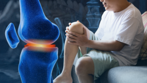 Osteonecrosis or 'bone death': What to know about Angelica Panganiban's ...