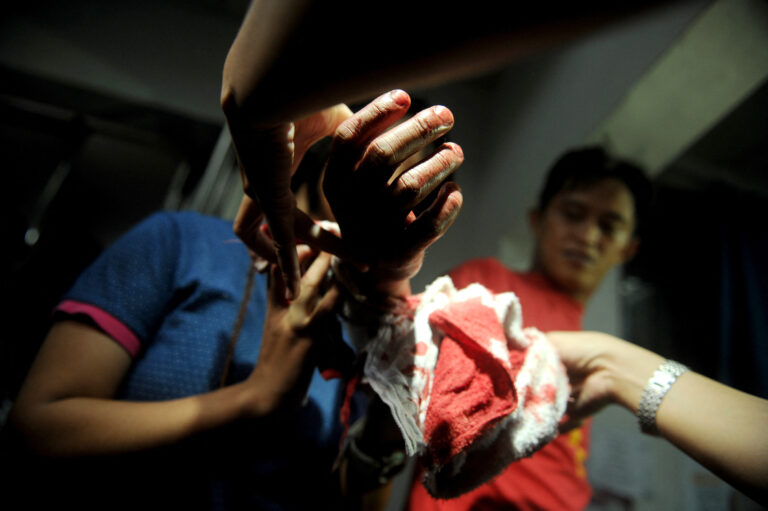 DOH: Firecracker-related injuries rise to 163