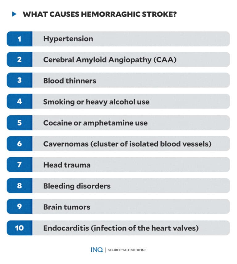 Hemorrhagic stroke: What to know about Arnold Clavio’s health scare