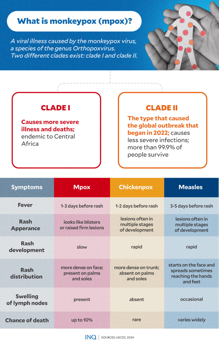 Mpox: What is it, how it spreads, care for patients