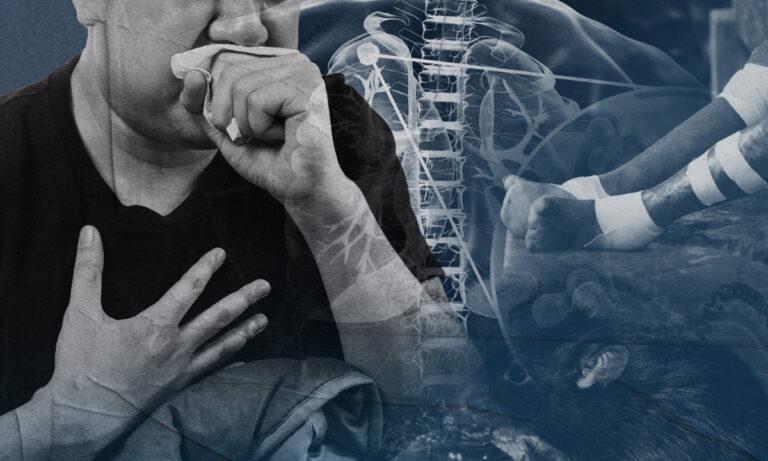 PH ranks high in neglected tropical diseases: What to know | Inquirer News