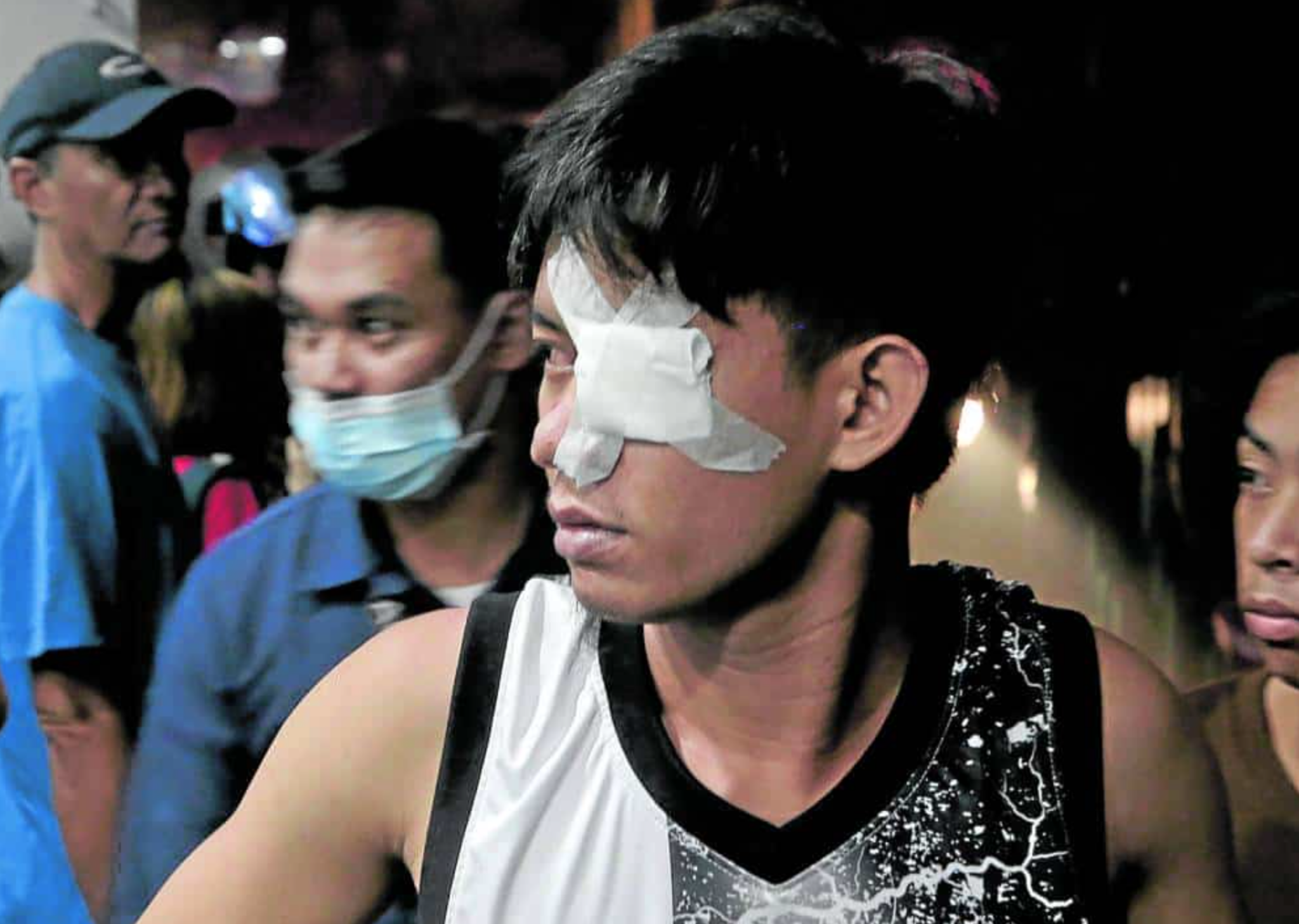 Fireworks casualties breach 800, fatalities now 4