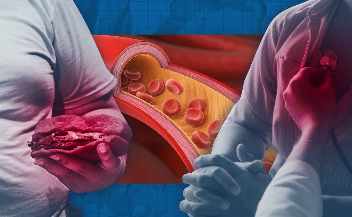 High bad cholesterol: The silent threat, how to fight it