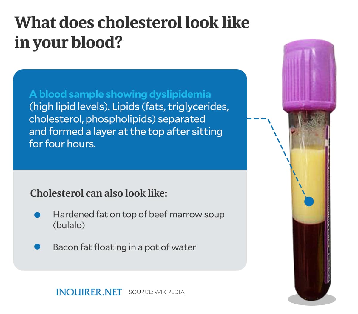 High bad cholesterol: The silent threat, how to fight it